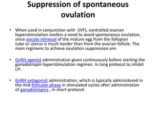 In Vitro Fertilization - IVF | PPTX