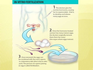 In Vitro Fertilization- The Complete Picture | PPT