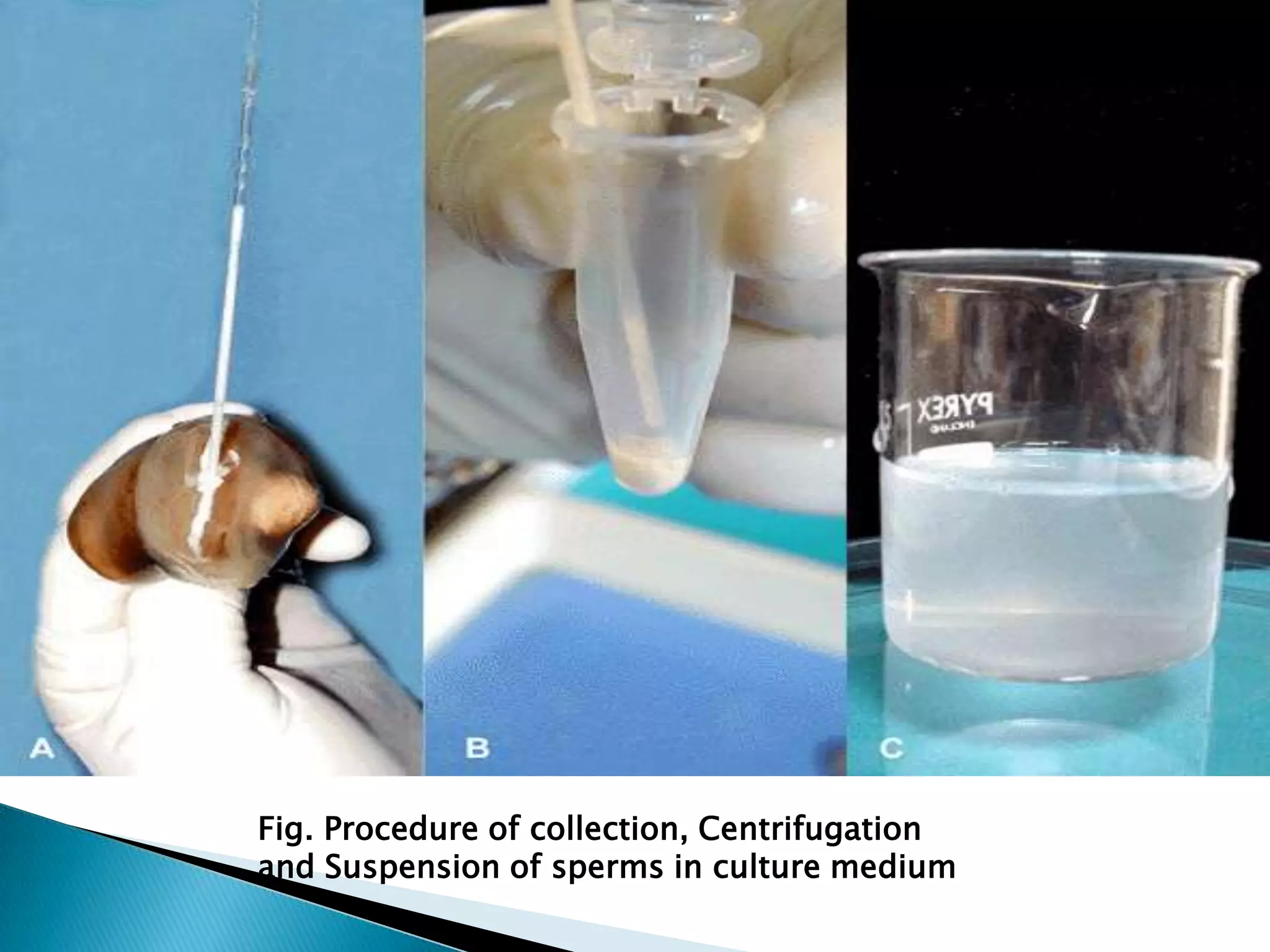 In vitro fertilization and embryo transfer in humans | PPTX