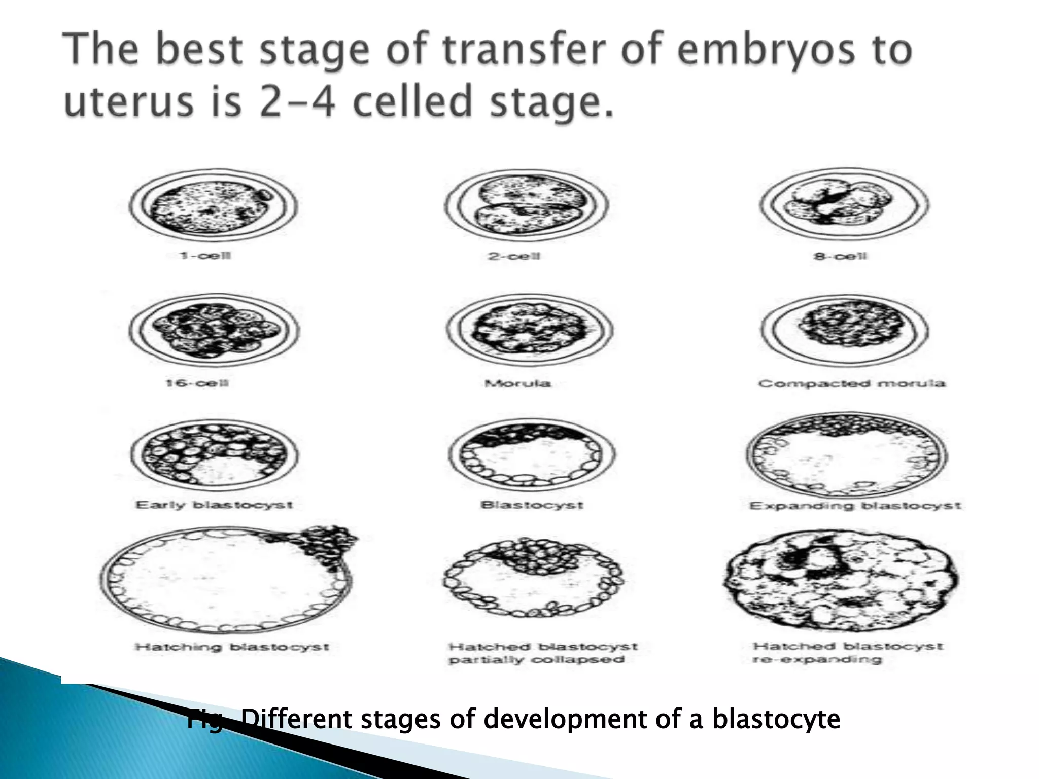 In vitro fertilization and embryo transfer in humans | PPTX