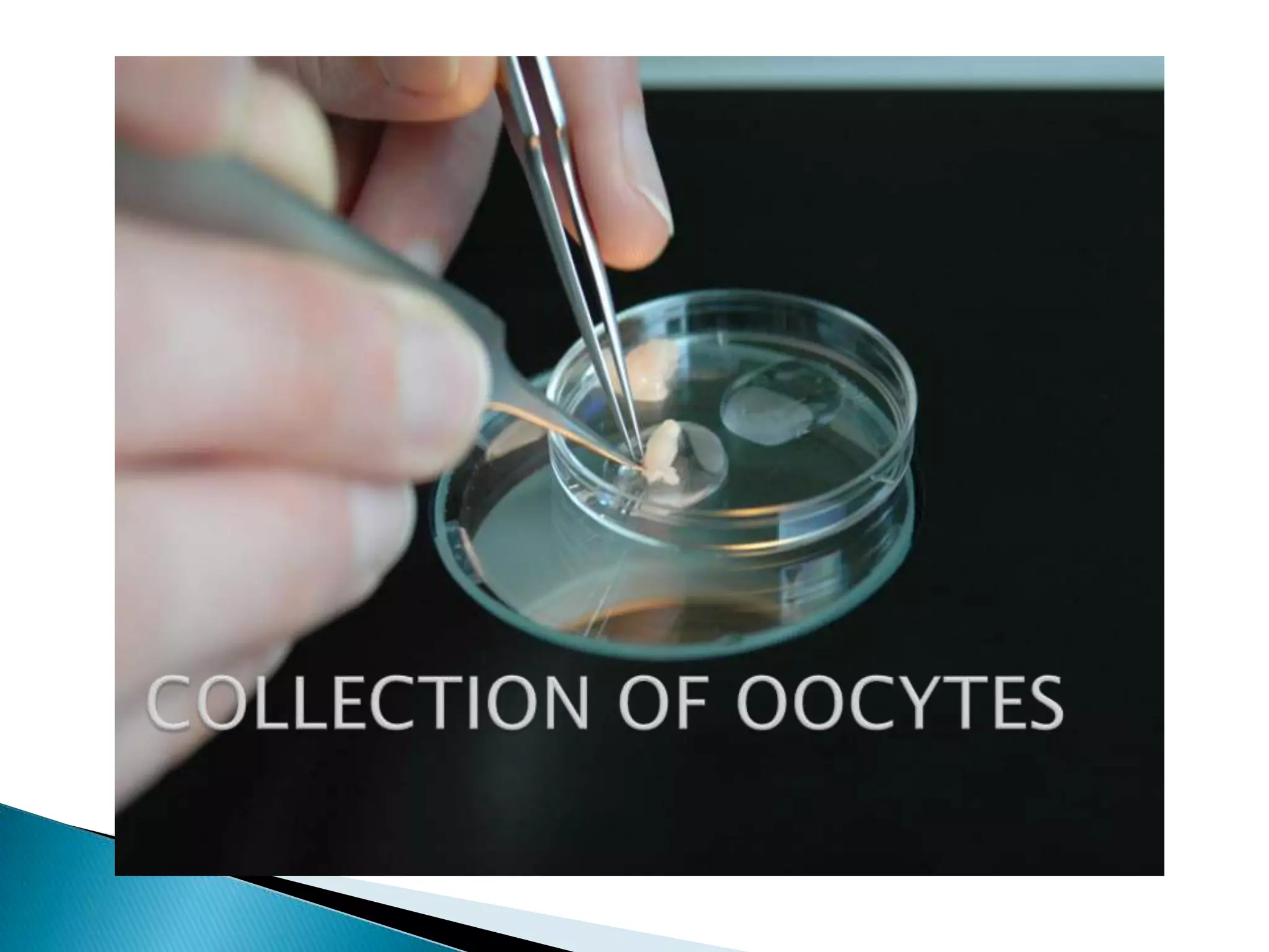 In vitro fertilization and embryo transfer in humans | PPTX