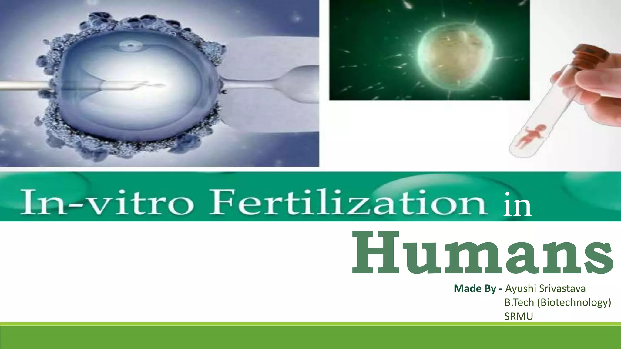 Invitro fertilization in humans | PPTX