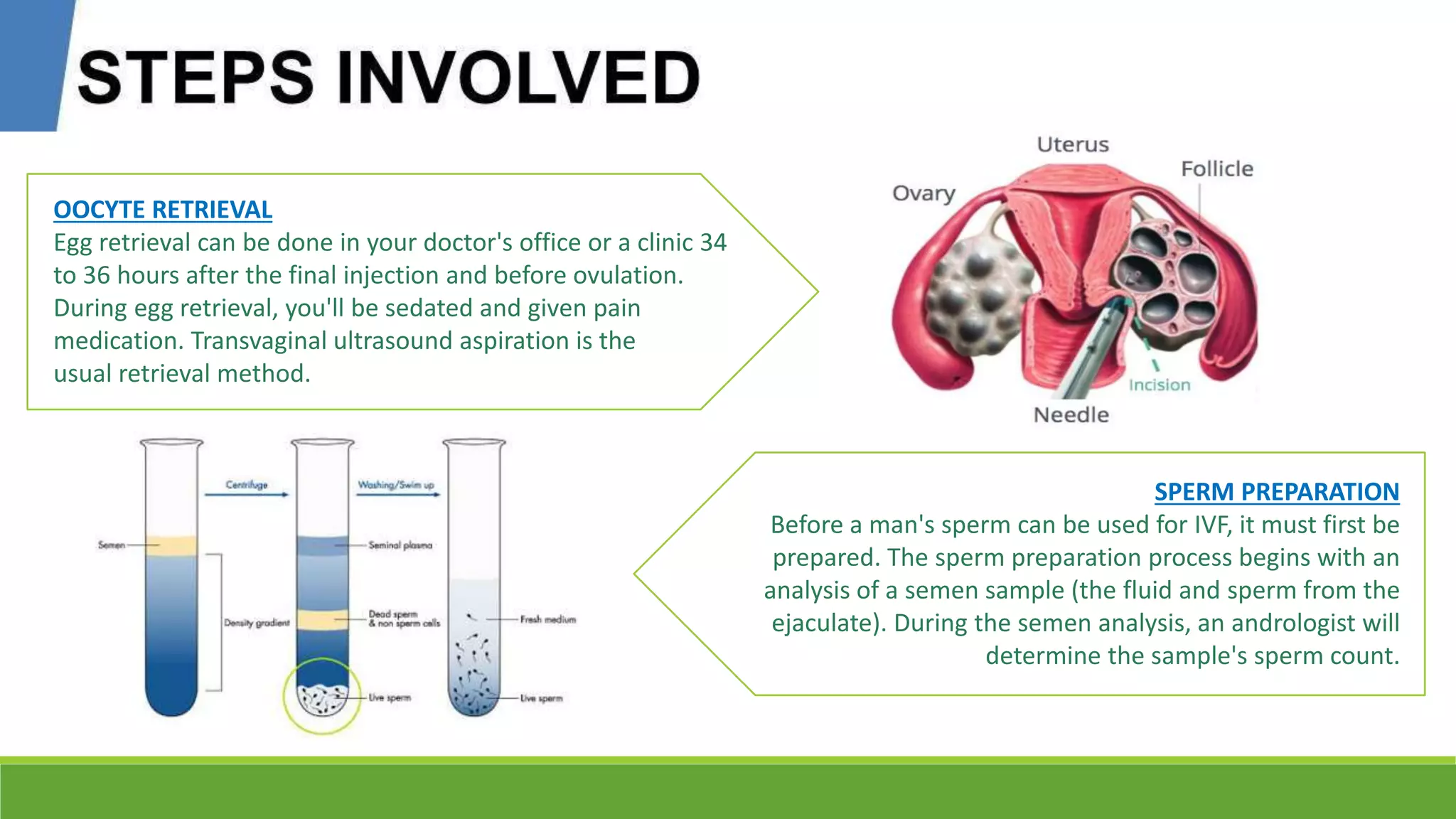 Invitro fertilization in humans | PPTX