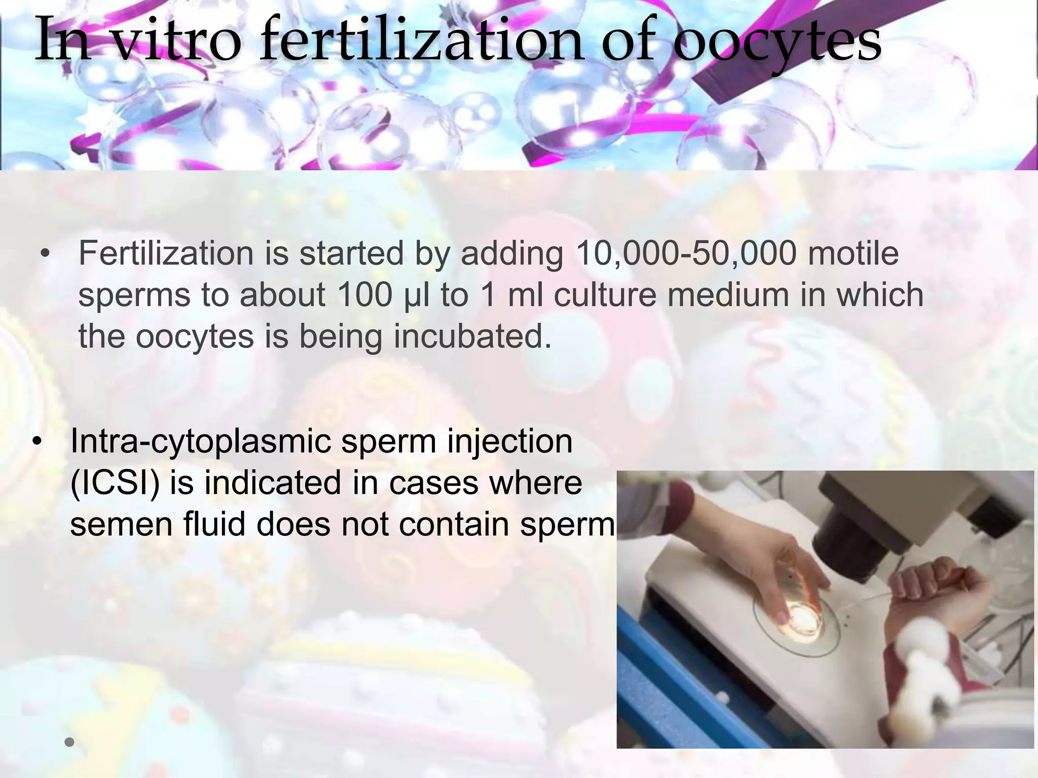 In vitro fertilization methods | PPTX