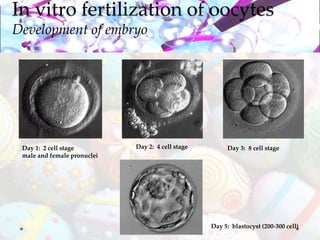 In vitro fertilization methods | PPTX