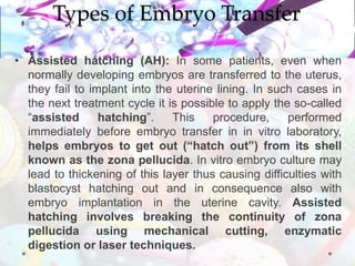 In vitro fertilization methods | PPTX