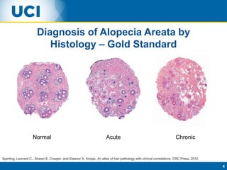 In Vivo Imaging in Alopecia Areata Patients Using Multiphoton ...