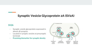 In vivo measurement of widespread synaptic loss in Alzheimer’s Disease with SV2A PET (2).pptx