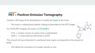 In vivo measurement of widespread synaptic loss in Alzheimer’s Disease with SV2A PET (2).pptx