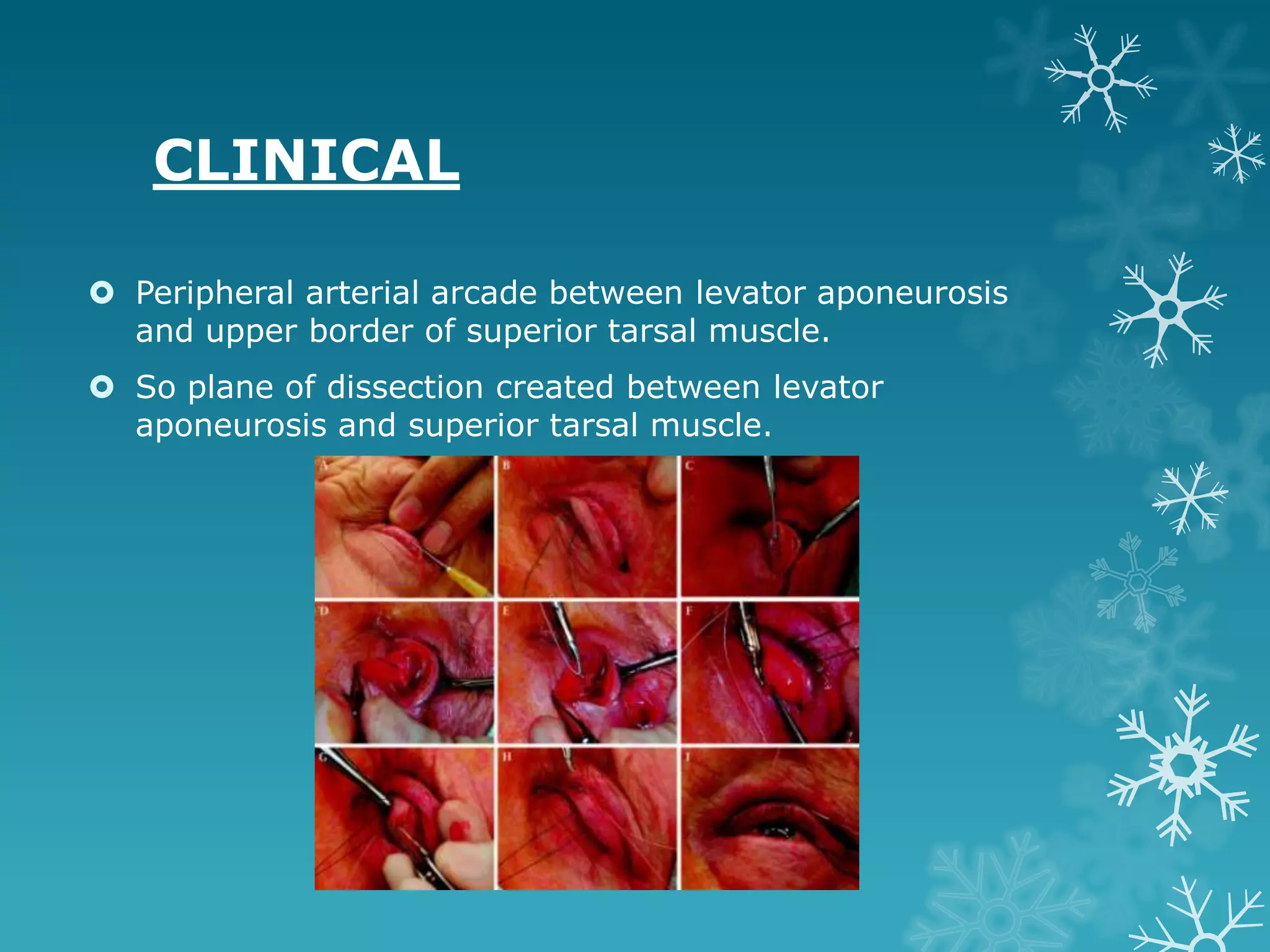 Involuntary extraocular muscles | PPTX