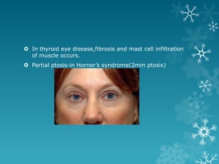 Involuntary extraocular muscles | PPTX