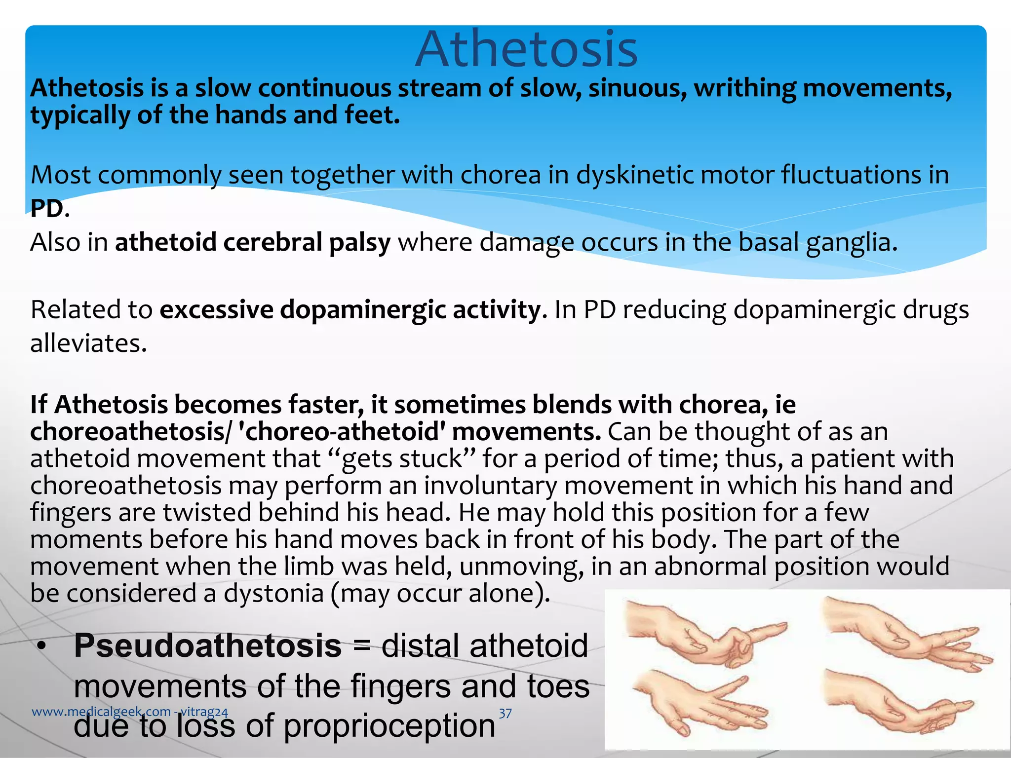 Involuntary movements | PDF