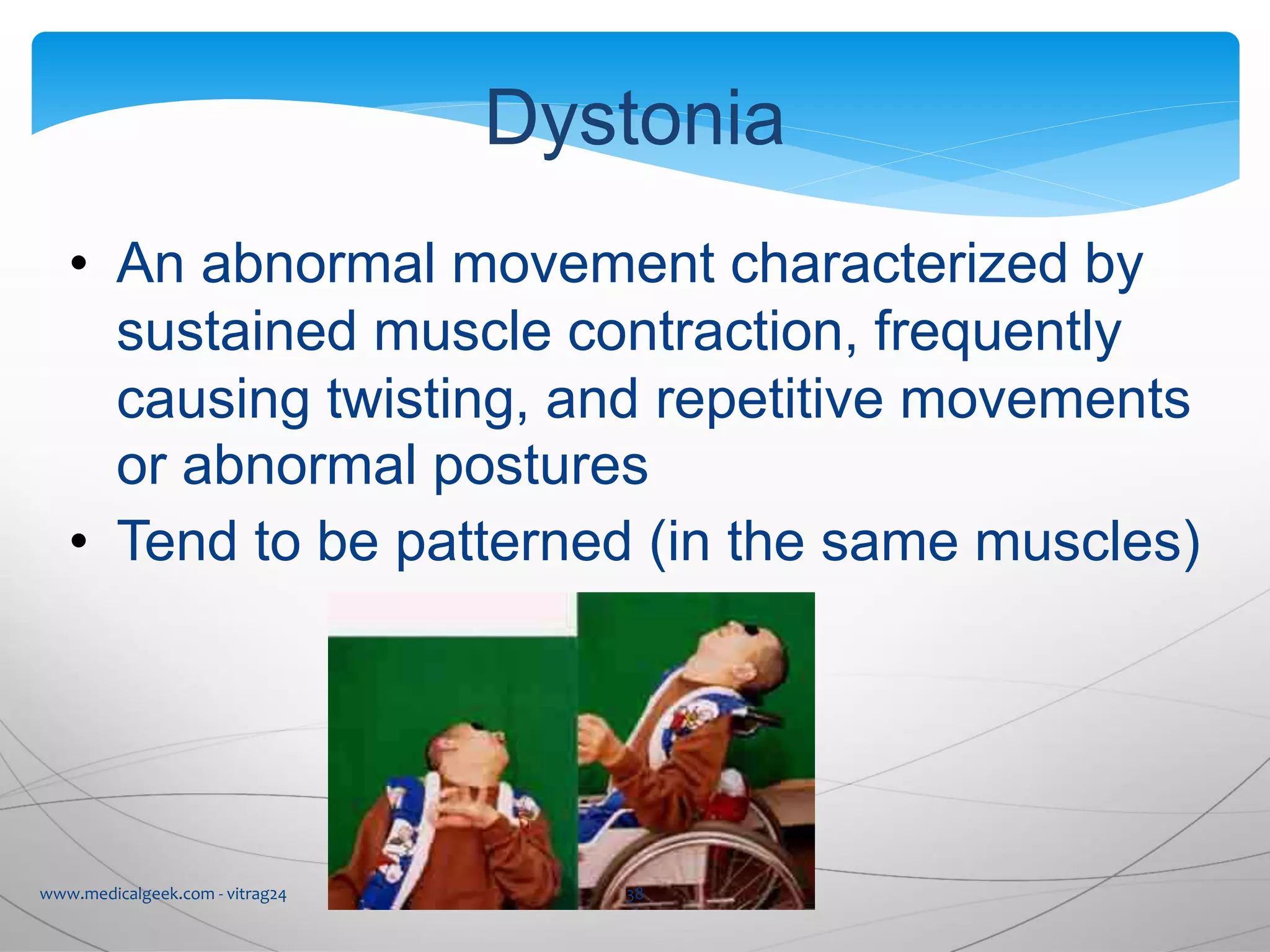 Involuntary movements | PDF