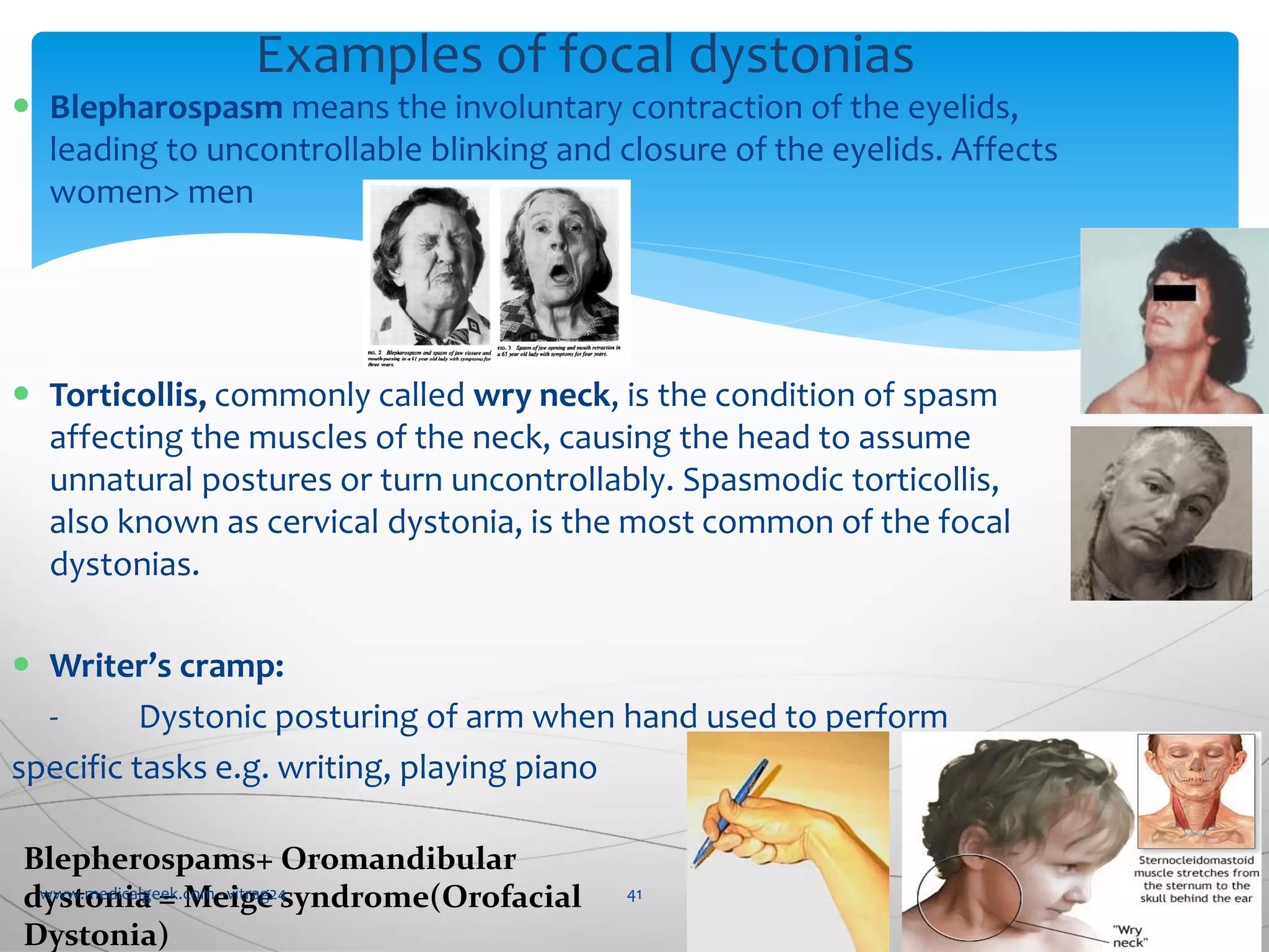 Involuntary movements | PDF