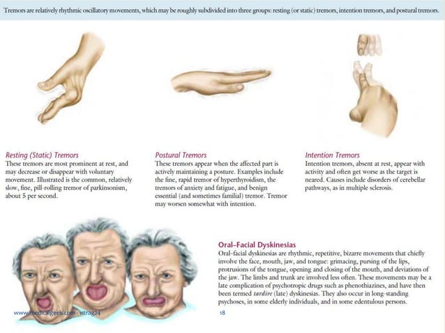 Involuntary movements | PDF