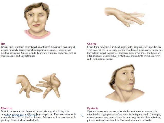 Involuntary movements