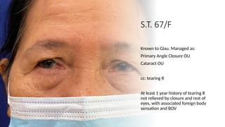 Involutional Entropion Plastics Lacrimal Orbit.pptx