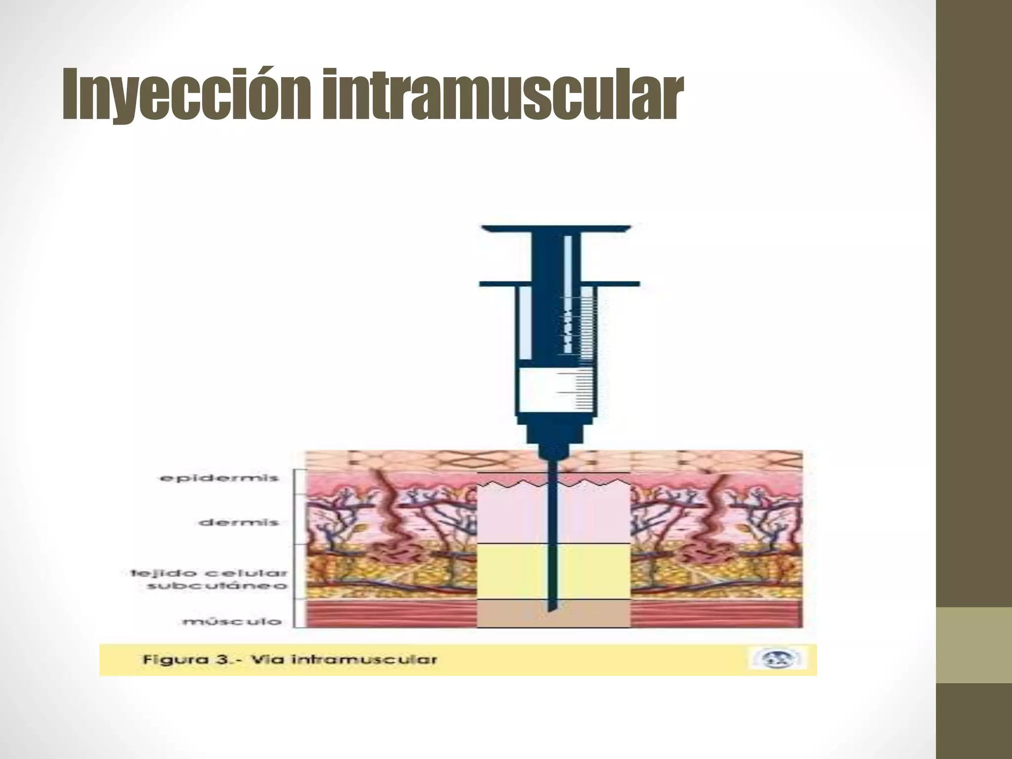 Inyección intramuscular | PPTX