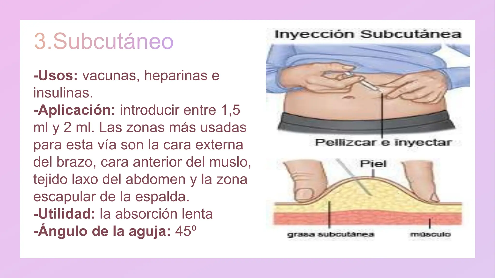 Comprencio de inyectable basico para una buena tecnica | PPTX