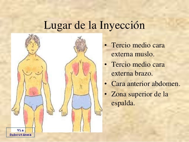 Inyectoterapia pptminimizer.ppt