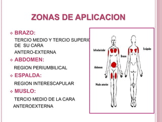 INYECTOTERAPIA - VIAS DE ADMINISTRACIÓN.ppt