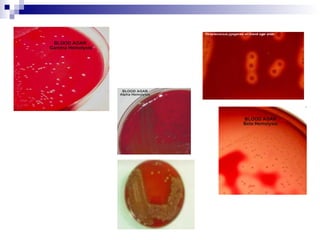 [Micro] bacterial selective & differential media | PPT