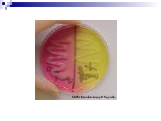 [Micro] bacterial selective & differential media | PPT | Blood ...