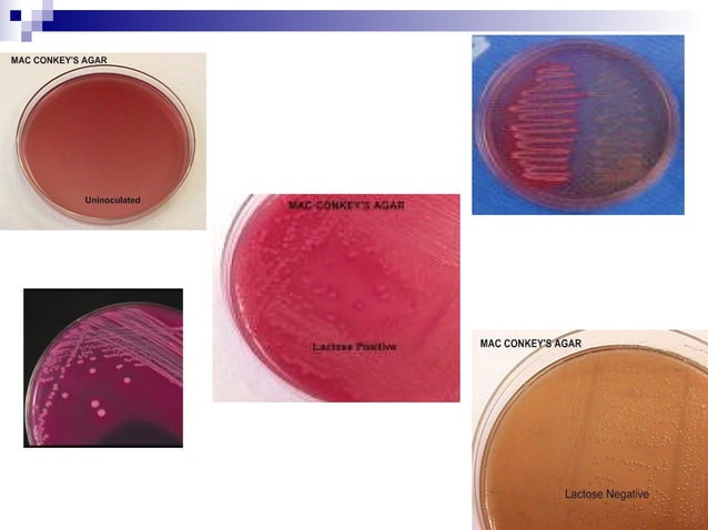 [Micro] bacterial selective & differential media | PPT | Blood ...
