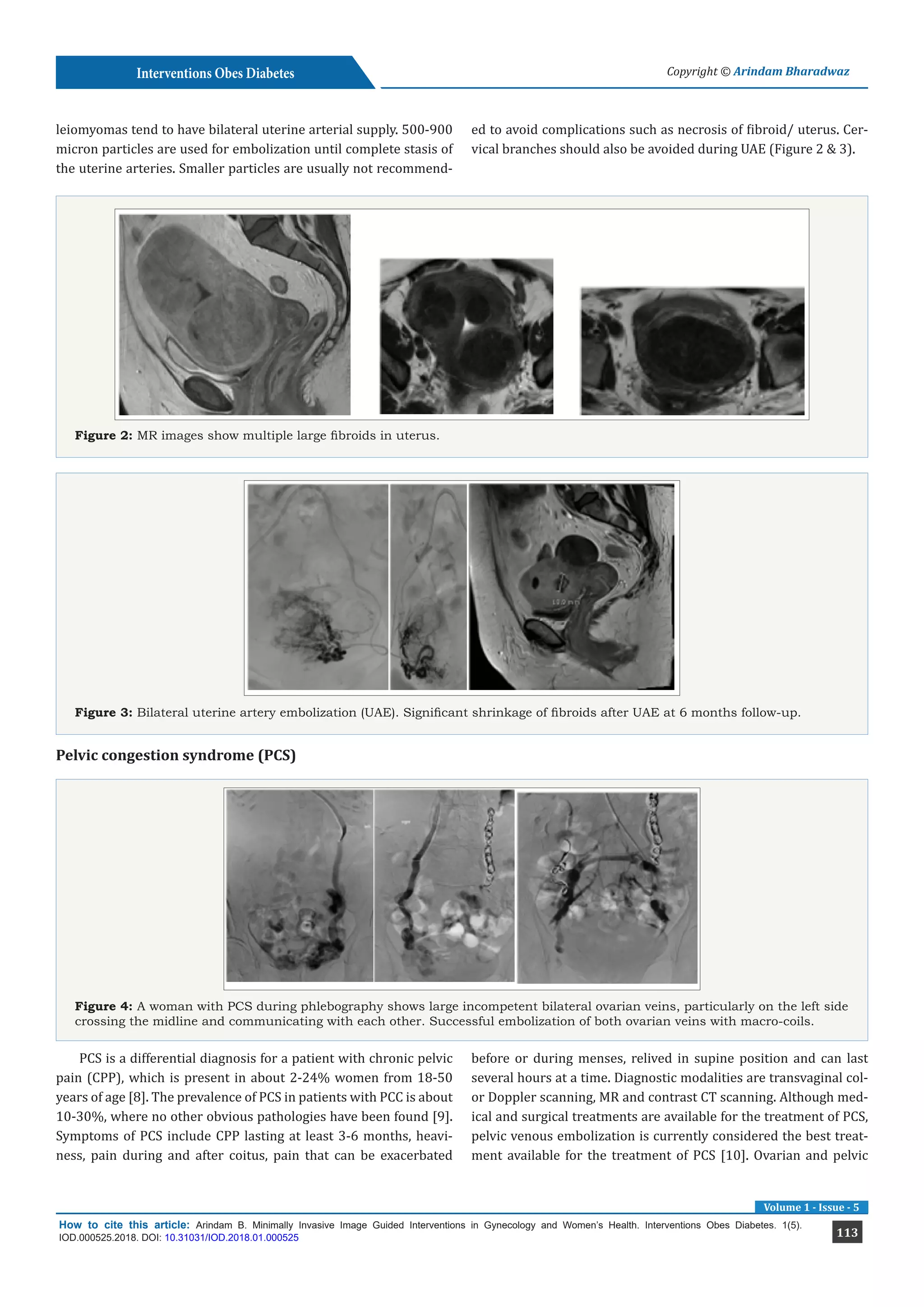 Minimally Invasive Image Guided Interventions in Gynecology and Women’s Health | PDF