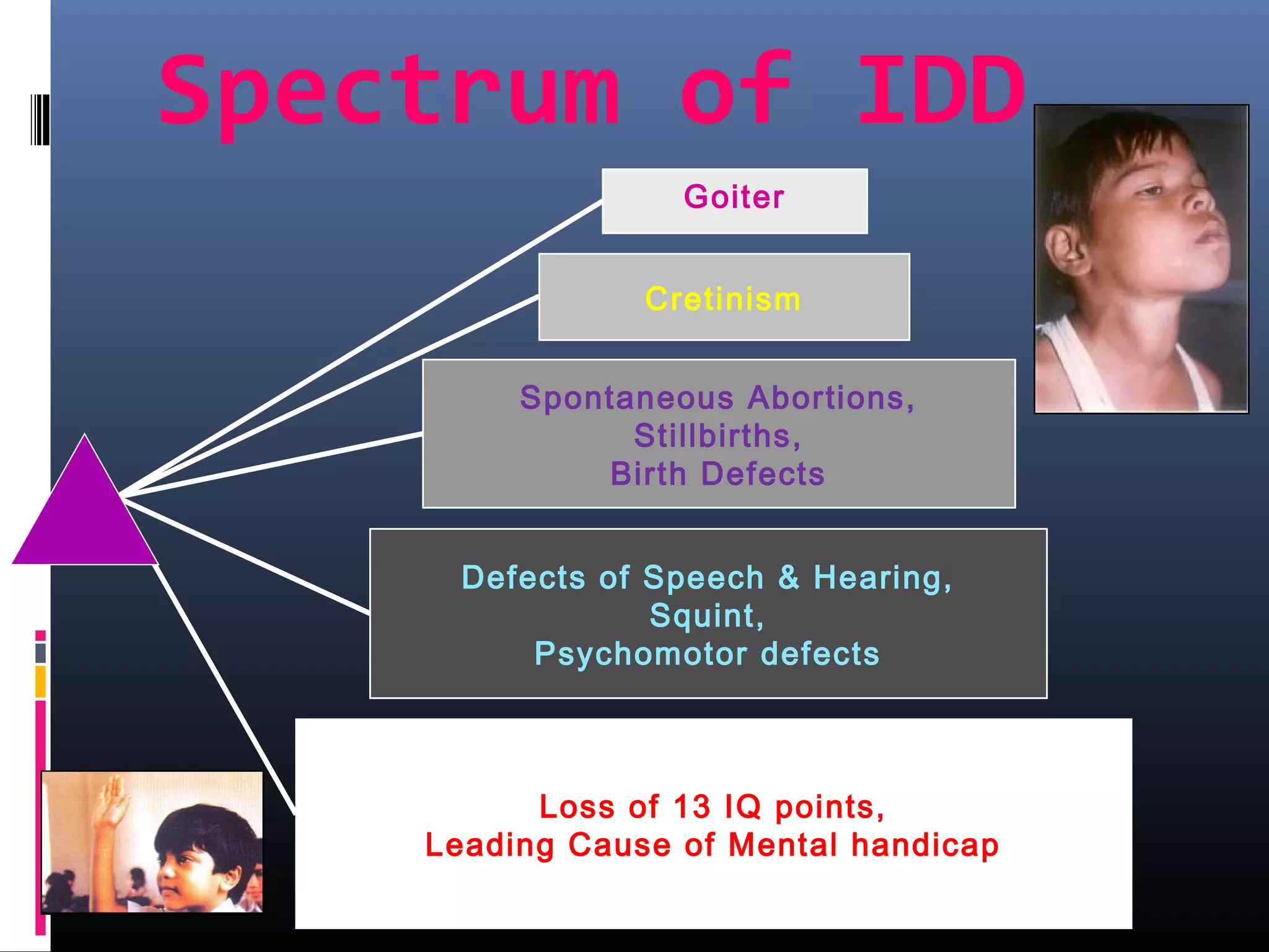Iodine defficiancy disorders | PPT