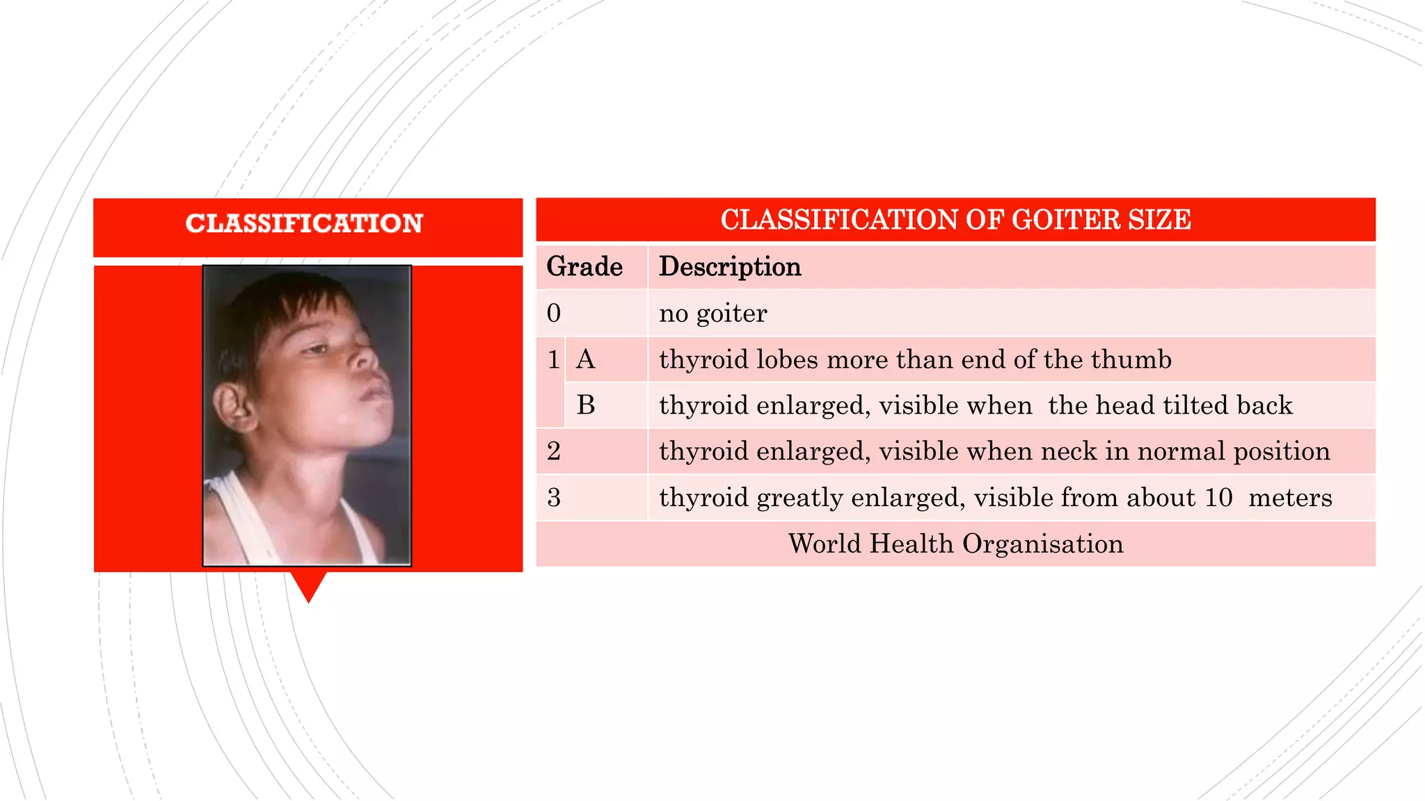 Iodine for mother and fetus | PPTX