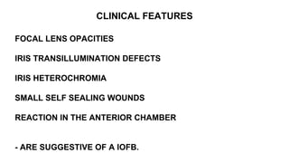 IOFB , INTRAOCULAR FOREIGN BODY | PPTX