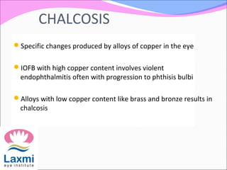 INTRAOCULAR FOREIGN BODY | PPT