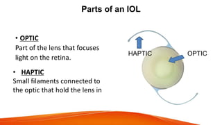 Intaoccular lens | PPT
