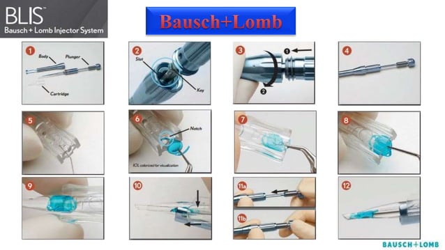 IOLCatridge-Injector Systems | PPTX