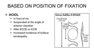 IOL IN CATARACT SURGERY.pptx
