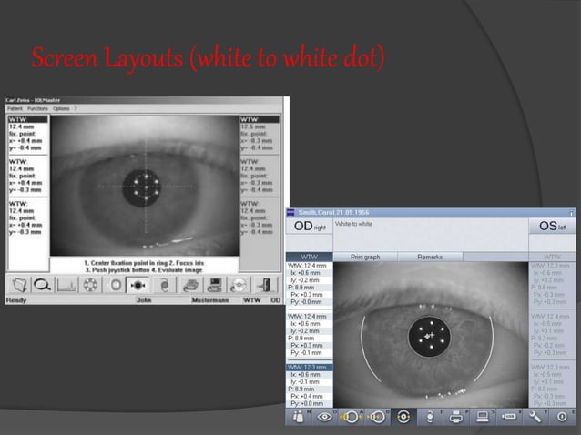 IOL Master | PPTX