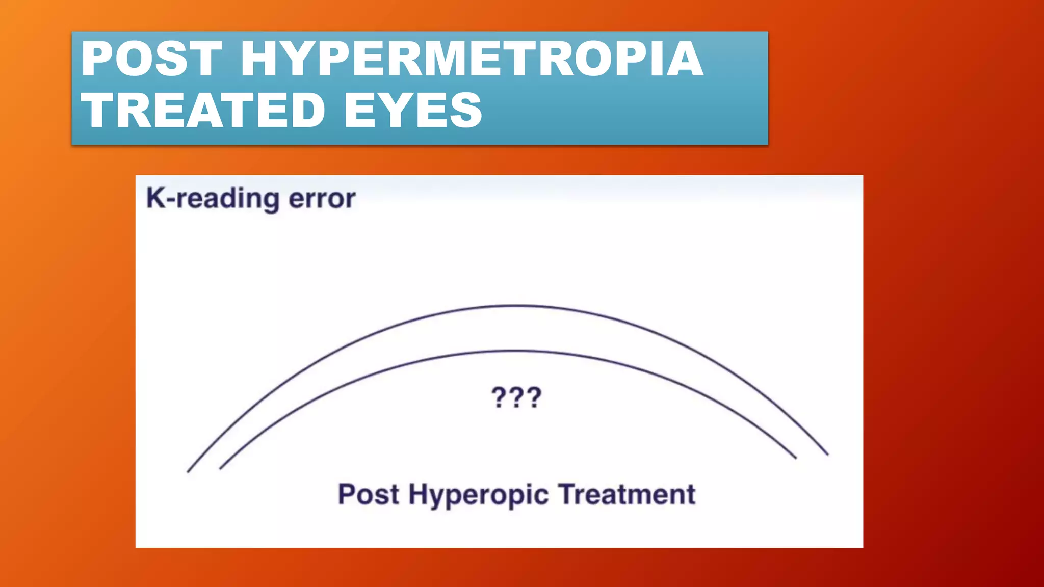 Iol power calculation normal and post lasik eyes | PPTX