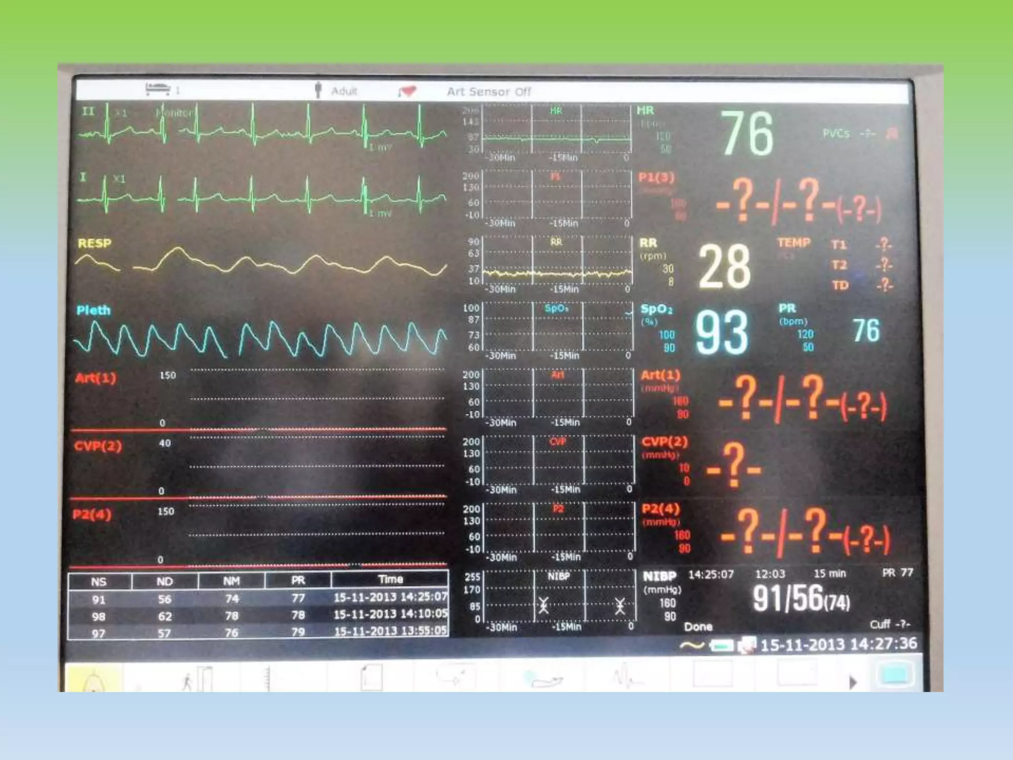 Intraoperative Monitoring for Brain and Spinal Cord Tumors | PPTX