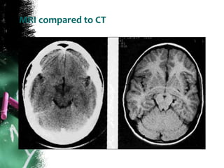Multiple sclerosis case scenario study based | PPT