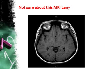 Multiple sclerosis case scenario study based | PPT