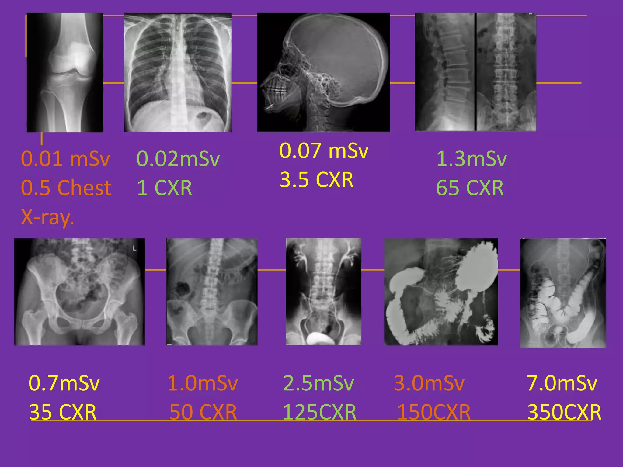 Ionizing radiation protection | PPT