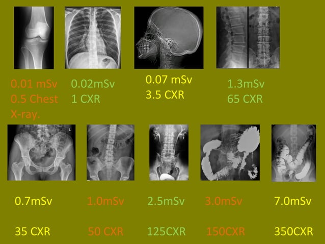 Ionizing radiation hazards and safety :must know | PPS | Medical Tests ...