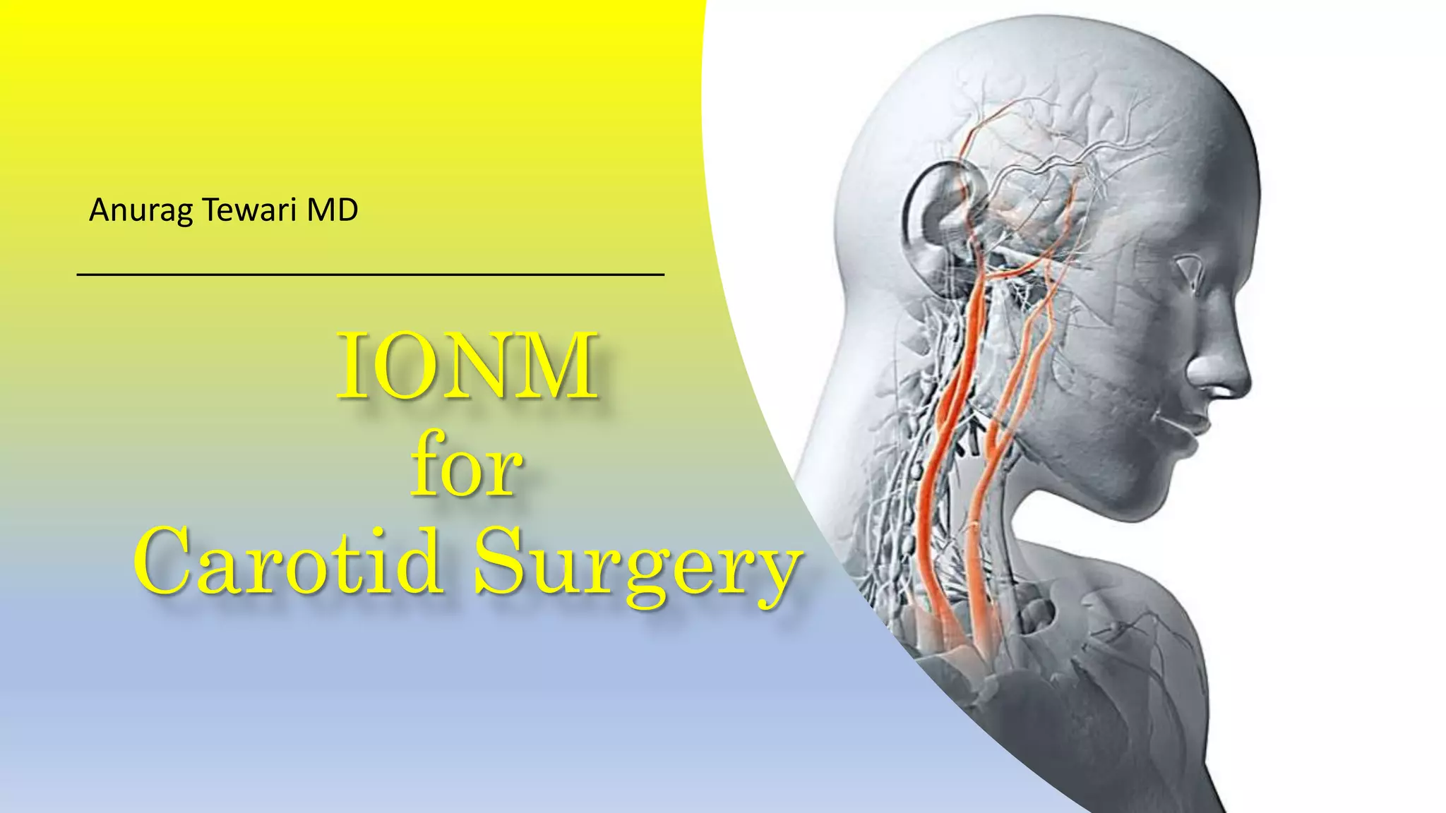 IONM for Carotid Surgery & Carotidendartectomy | PPTX
