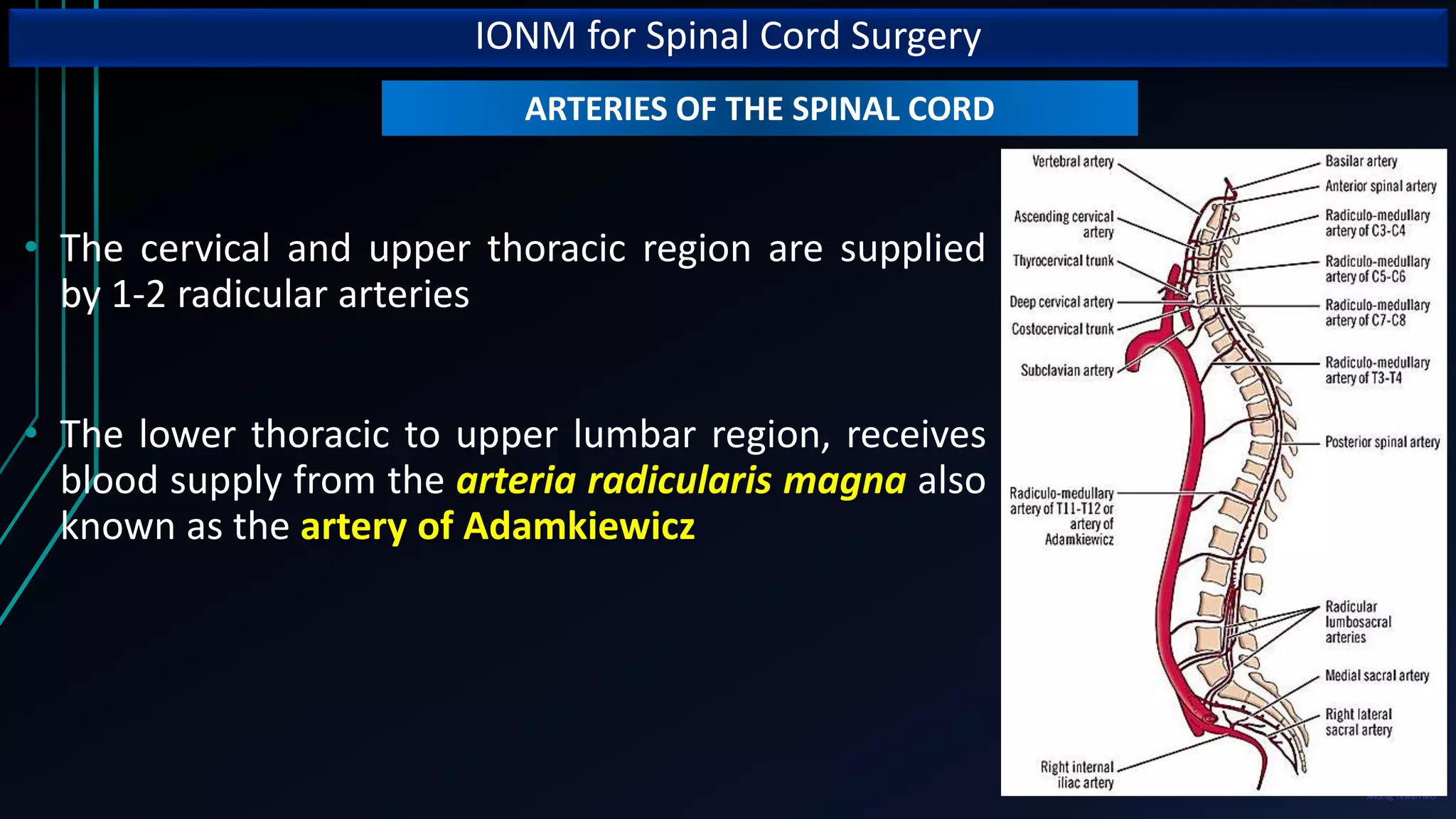 IONM for Spinal Cord Surgery | PPTX