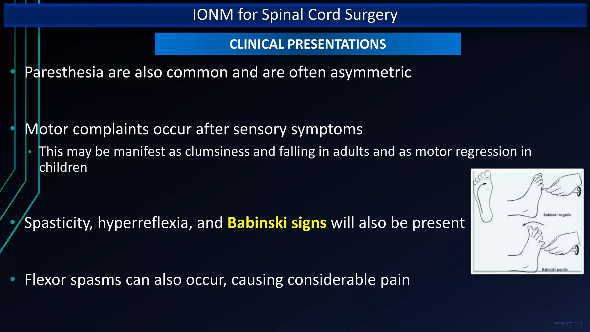 IONM for Spinal Cord Surgery | PPTX
