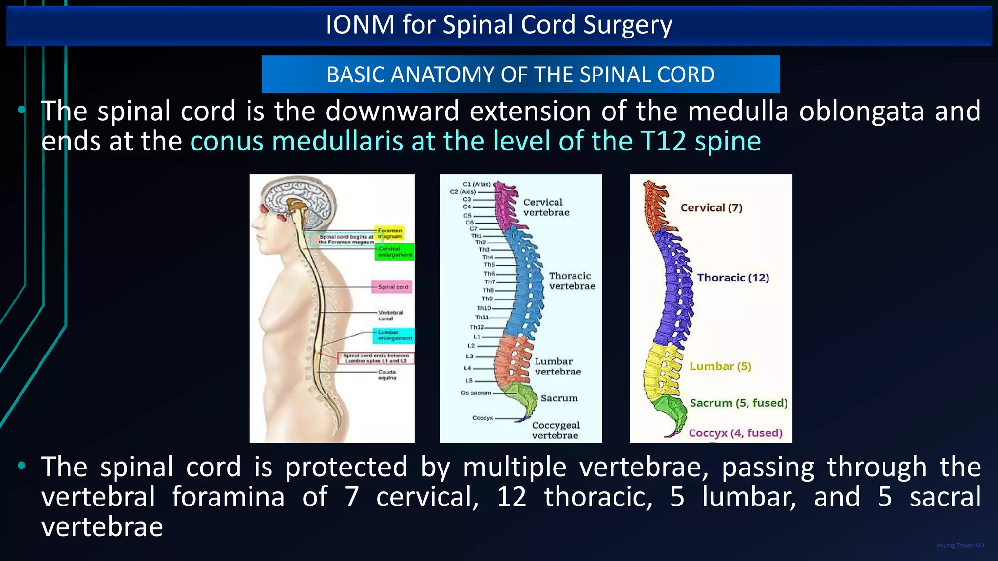 IONM for Spinal Cord Surgery | PPTX