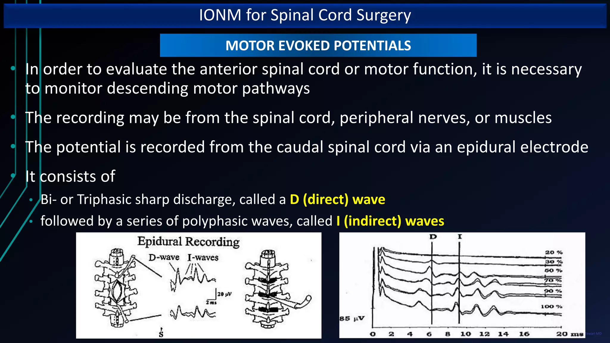 IONM for Spinal Cord Surgery | PPTX