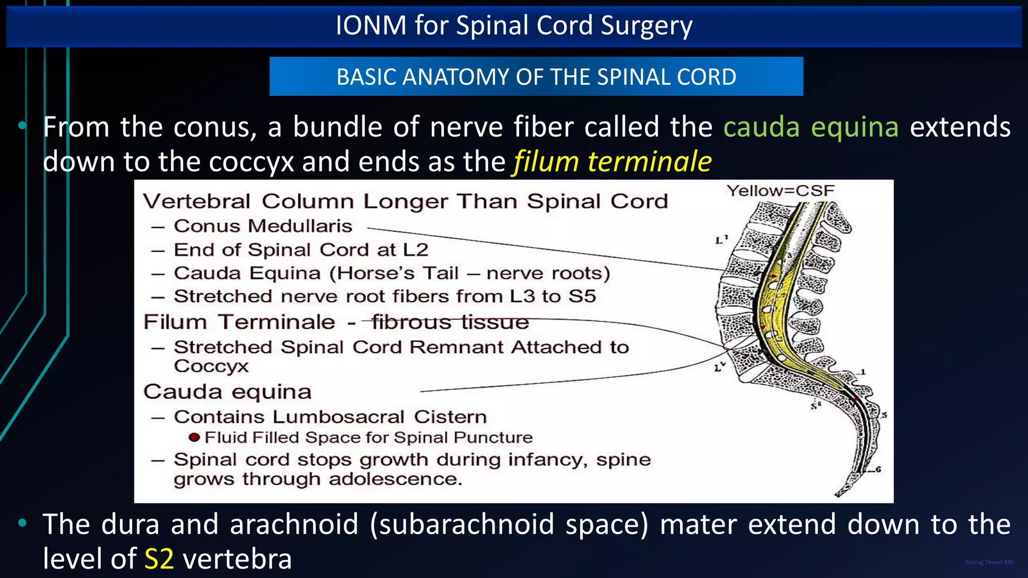 IONM for Spinal Cord Surgery | PPTX