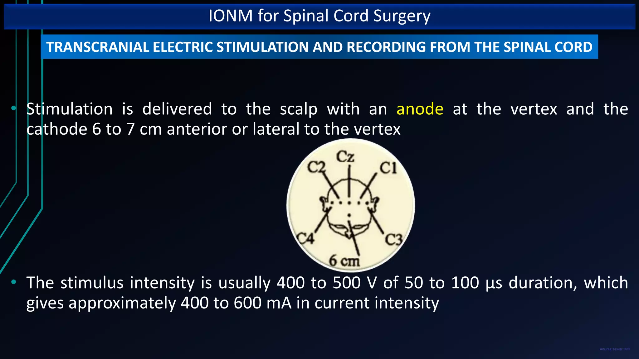 IONM for Spinal Cord Surgery | PPTX